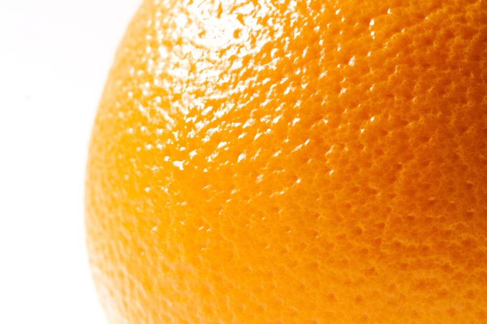 Cellulite